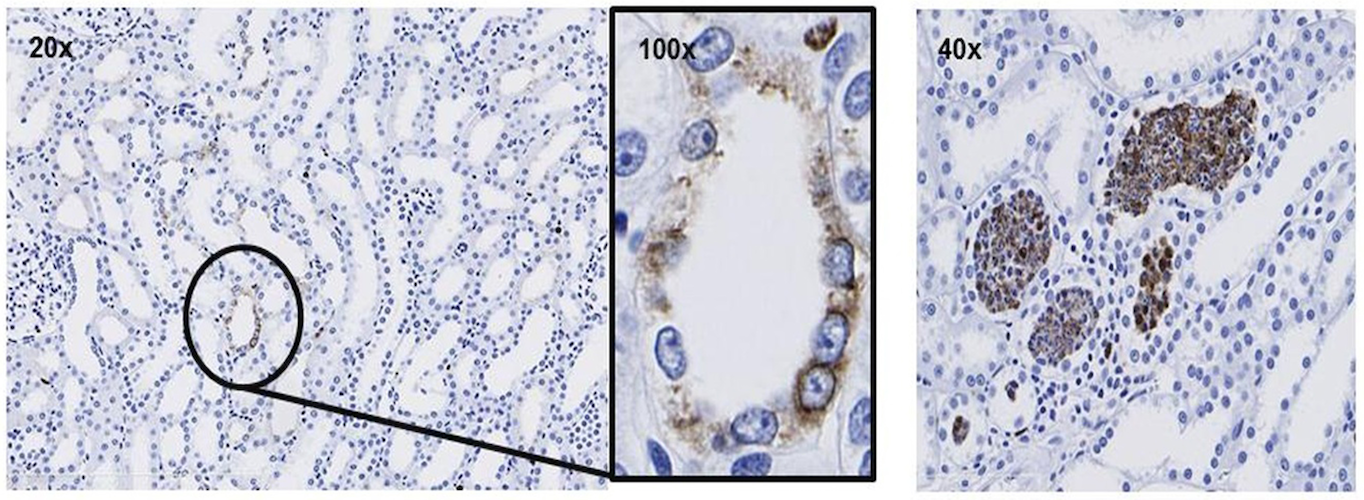 Anti-NGAL (monkey) - Bioporto
